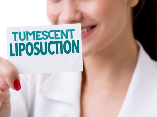 Tumescent Liposuction - The Laser Studio